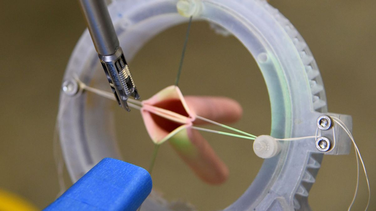 Verity - Robot Performs Surgery Autonomously With 100% Success Rate